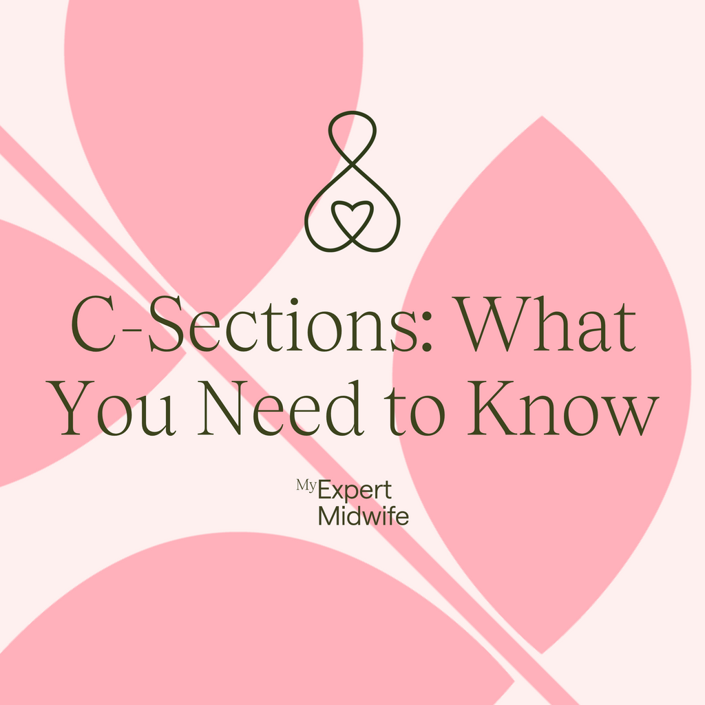 C-sections: Everything You Need To Know – My Expert Midwife