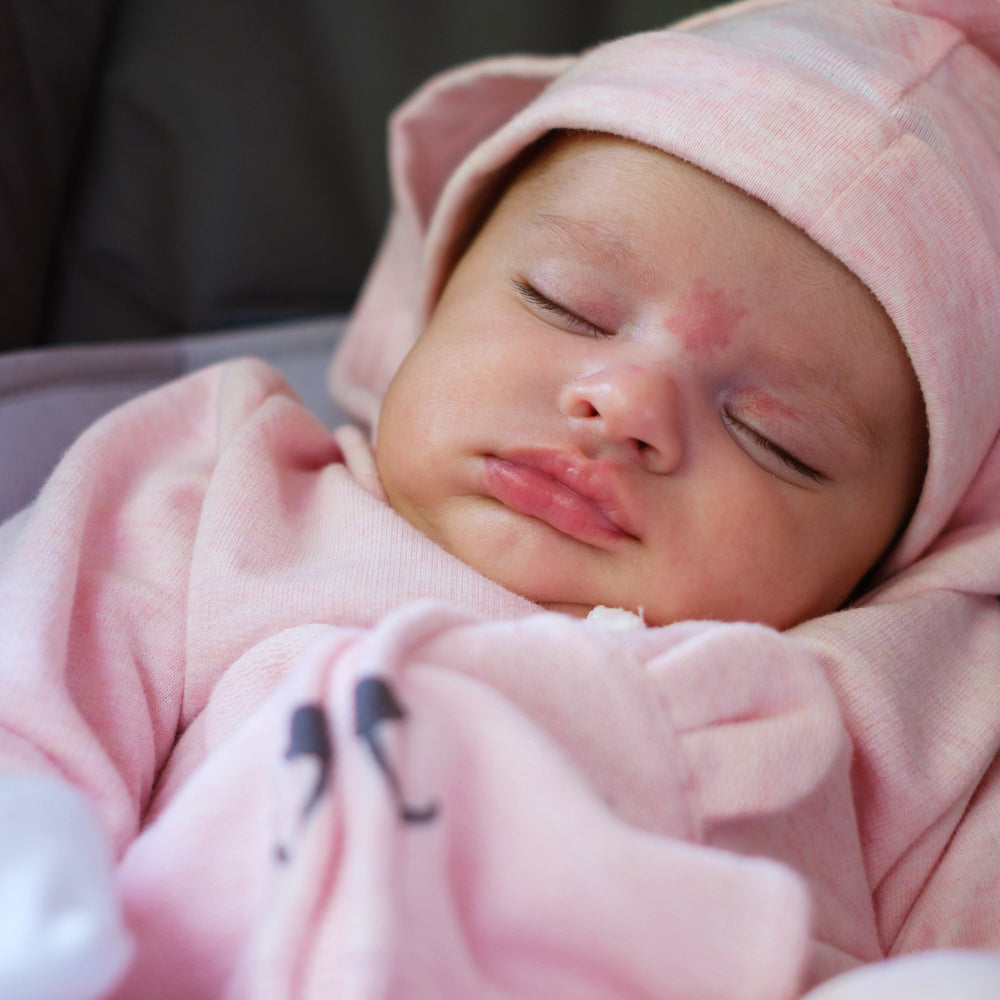 Birthmarks in Babies: What They Are, Why They Happen & When to See – My ...